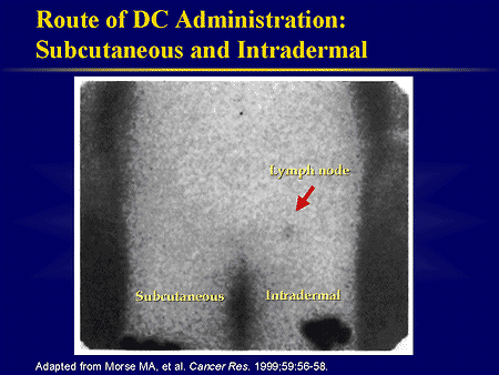 Therapeutic Cancer Vaccines: Targeting the Future of Cancer Treatment