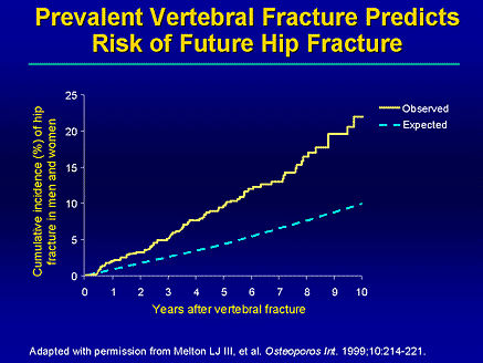Effective Therapeutic Options for Hip Fractures in Osteoporosis