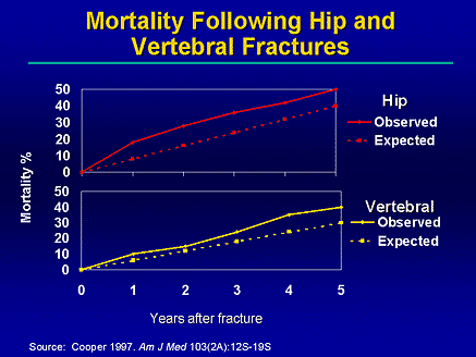 Effective Therapeutic Options for Hip Fractures in Osteoporosis