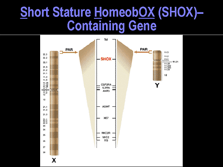 Turner Syndrome: Toward Early Recognition and Improved Outcomes
