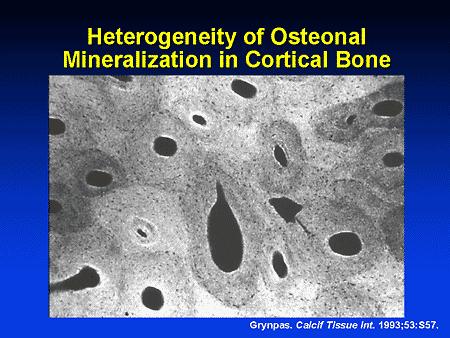 New Paradigms in the Management of Osteoporosis