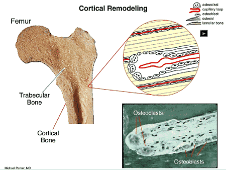 New Paradigms in the Management of Osteoporosis