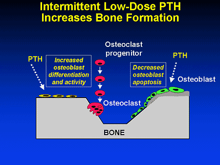 New Paradigms in the Management of Osteoporosis