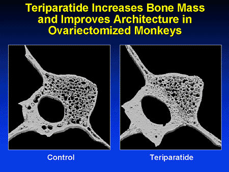 New Paradigms in the Management of Osteoporosis