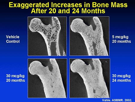 New Paradigms in the Management of Osteoporosis