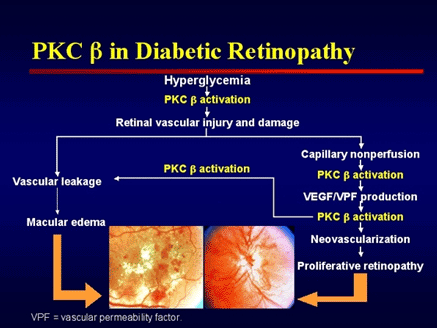 The Role of Protein Kinase C in Diabetic Microvascular Damage