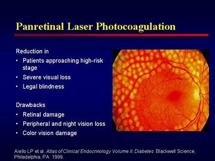 The Role of Protein Kinase C in Diabetic Microvascular Damage