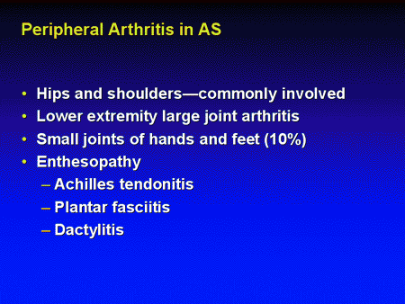 Advancing the Art and Science of Treating RA and Spondyloarthropathies ...