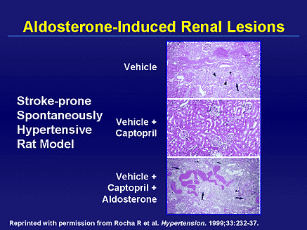 The Evolving Role of Aldosterone in Cardiovascular Disease: Rationale ...