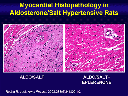The Evolving Role of Aldosterone in Cardiovascular Disease: Rationale ...