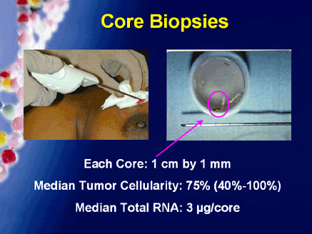 Optimizing Treatment Strategies in Breast Cancer: Use of Minimally ...