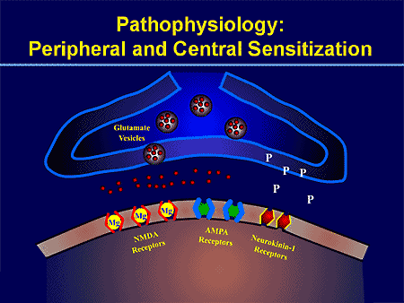 Managing Neuropathic Pain: New Approaches For Today's Clinical Practice