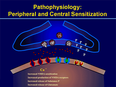 Managing Neuropathic Pain: New Approaches For Today's Clinical Practice