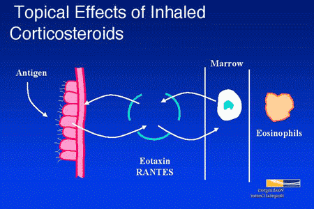 The Suspension Is Over: New Solutions for the Treatment of Asthma