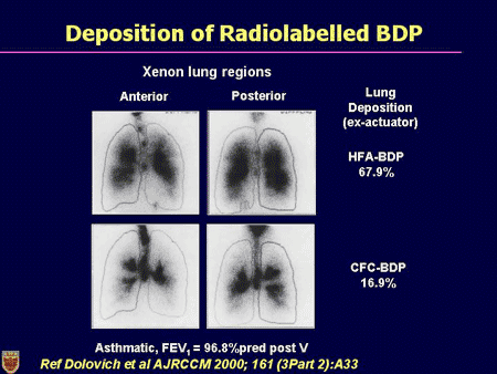 The Suspension Is Over: New Solutions for the Treatment of Asthma