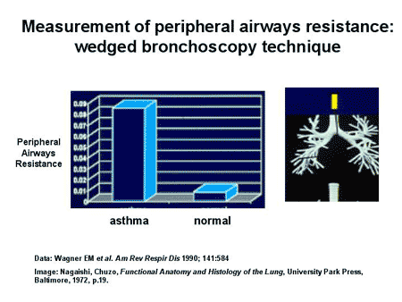 The Suspension Is Over: New Solutions for the Treatment of Asthma