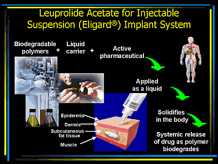 Improving Men's Health: Innovations in the Treatment of Prostate Cancer