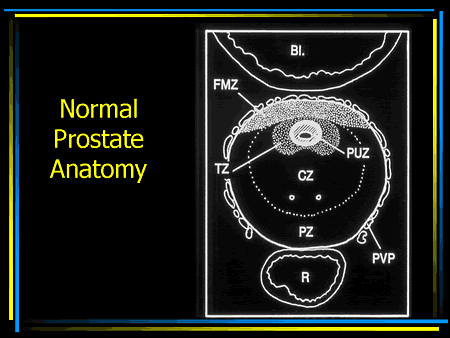 Improving Men's Health: Innovations in the Treatment of Prostate Cancer
