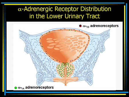 Improving Men's Health: Innovations in the Treatment of Prostate Cancer