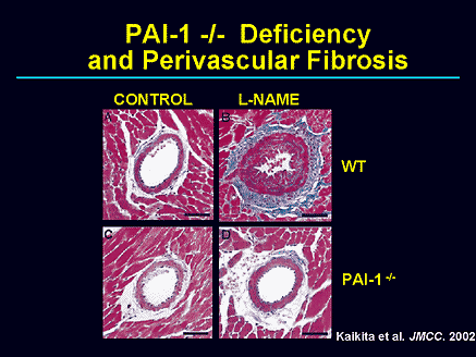 Establishing the Link Between Vascular Inflammation and Aldosterone in ...