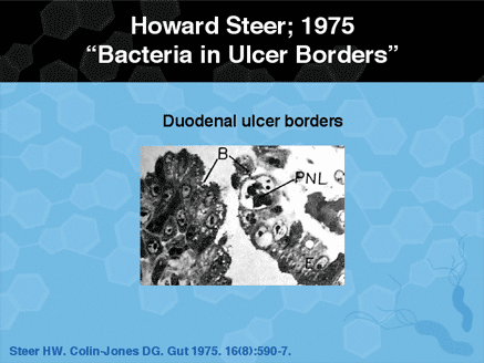 The Treatment of H. pylori: Where are We Now?