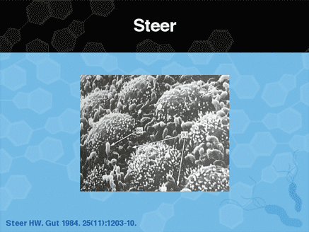 The Treatment of H. pylori: Where are We Now?