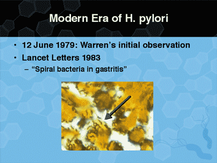 The Treatment of H. pylori: Where are We Now?