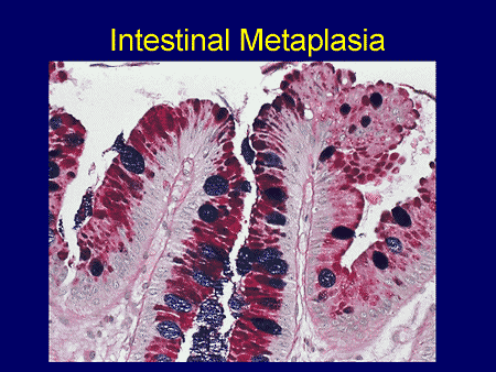 Closing the Gap in Upper GI Disorders: A Comprehensive Approach