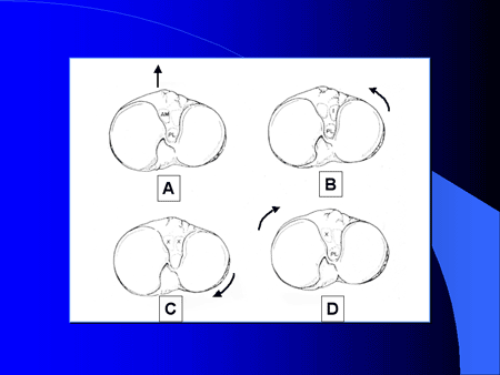 Innovative Perioperative Management in Orthopaedic Surgery: Maximizing ...