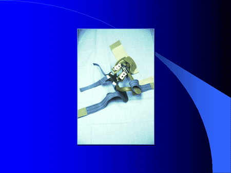 Innovative Perioperative Management in Orthopaedic Surgery: Maximizing ...