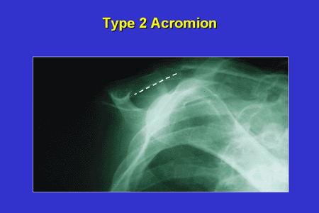 Safe and Effective Management of the Patient with Acute or Chronic Pain ...