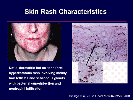 Targeting Critical Pathways in Oncology