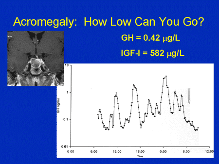 Advanced Strategies for Achieving IGF-I Control in Acromegaly