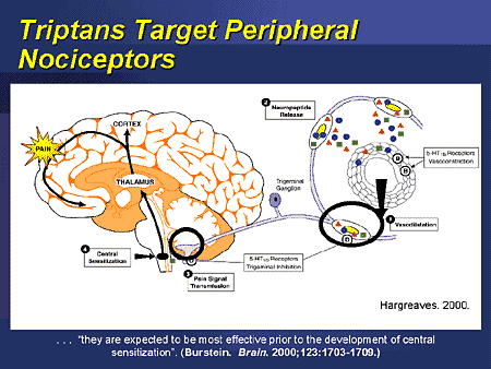 Managing Migraine: Translating Research into Clinical Practice
