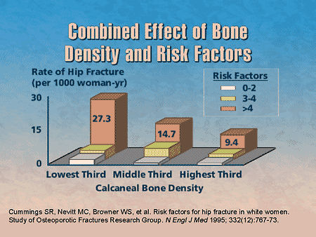 Osteoporosis: A New Era in Recognition and Treatment