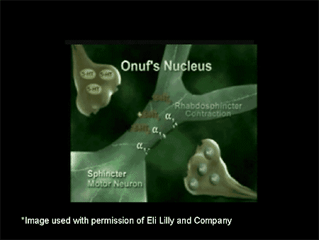 New Horizons in Stress Urinary Incontinence Treatment