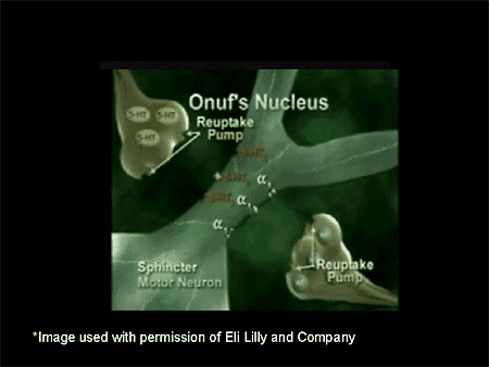 New Horizons in Stress Urinary Incontinence Treatment