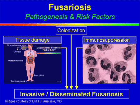 Management of Mycoses: Expanding Therapeutic Options