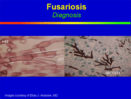 Management of Mycoses: Expanding Therapeutic Options