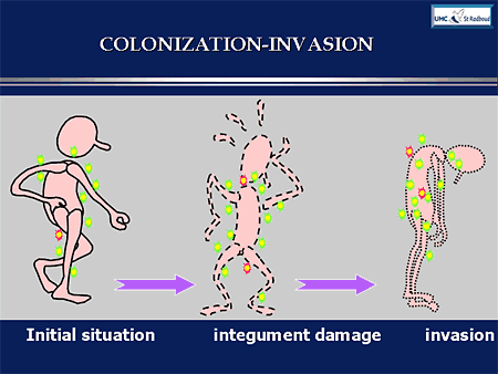 Management of Mycoses: Expanding Therapeutic Options