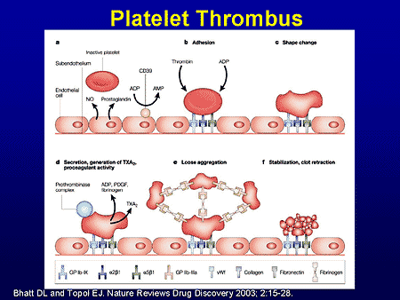 Challenges in the Long-term Management of Patients Post Stent ...