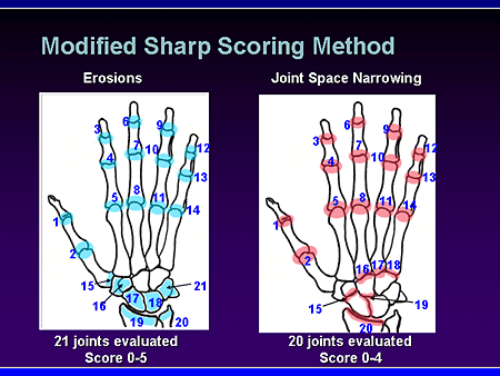 Targeting TNF: The Evolution of Biologic Therapy for the Treatment of ...