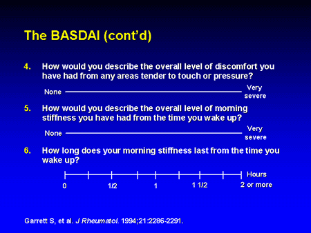 New Horizons in TNF Inhibition - Topic 1: Treating Ankylosing Spondylitis