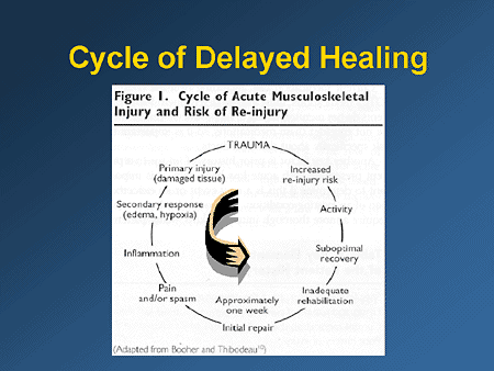 Emerging Solutions in Musculoskeletal Pain: The Role of Opioids in the ...