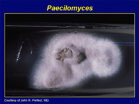 Update on Fungal Disease 2003