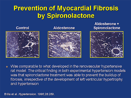 The Evolution of Heart Failure Management: The Role of Aldosterone