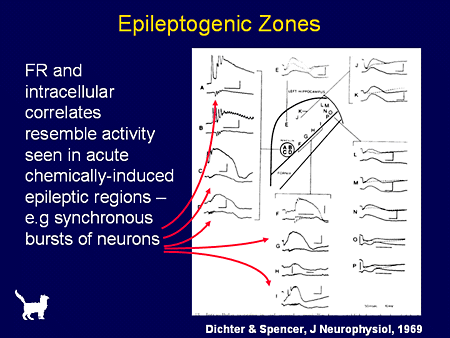 Temporal Lobe Epilepsy: The Current State of Knowledge