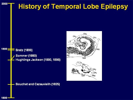 Temporal Lobe Epilepsy: The Current State of Knowledge