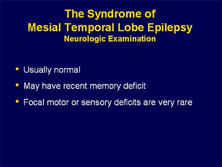 Temporal Lobe Epilepsy: The Current State of Knowledge