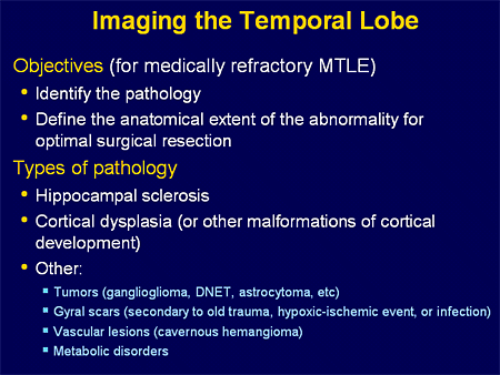 Temporal Lobe Epilepsy: The Current State of Knowledge
